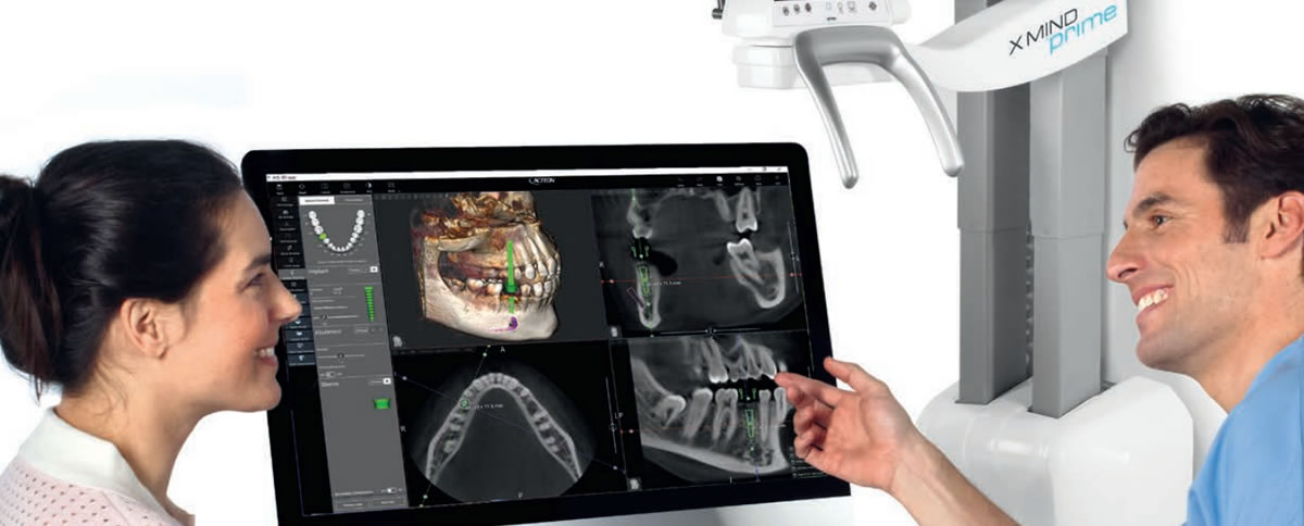 ¿Sabes los que es un escáner 3D? - Clínica Dental SpecialDent Marbella